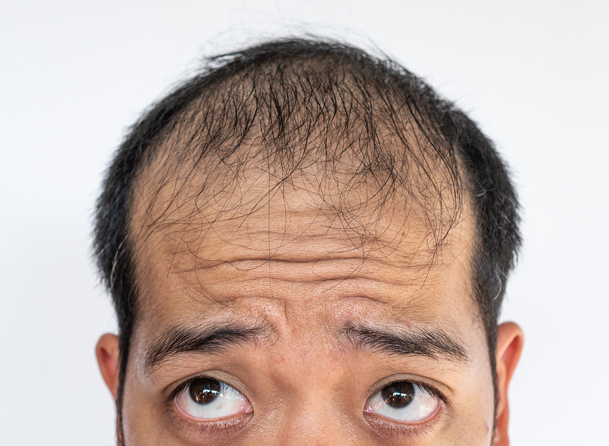 40 Silent Signs of Illness in Your Body